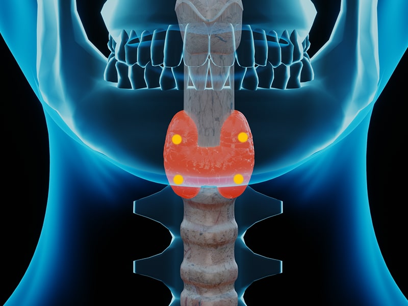 Paratiroid Bezi - Antalya Genel Cerrahi Uzmanı